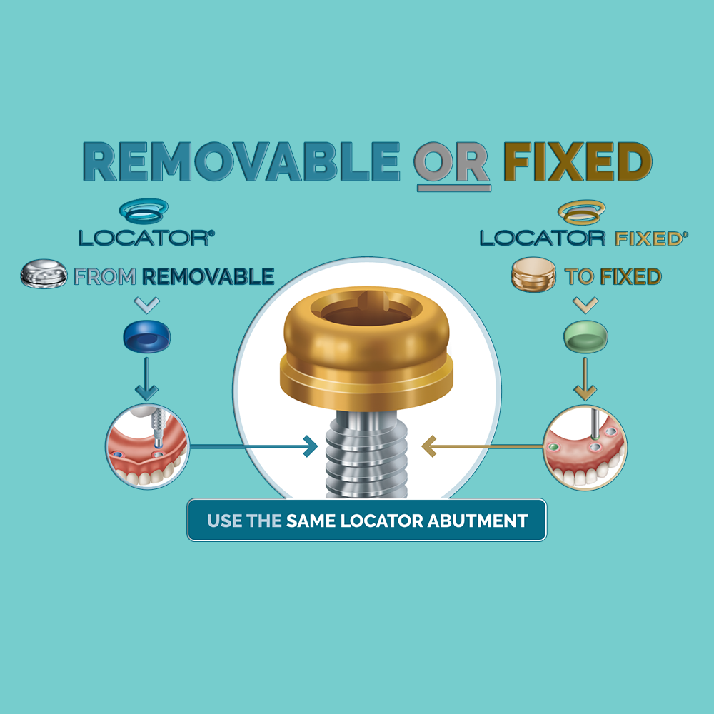 Fixed and removable dentures | Sodimed