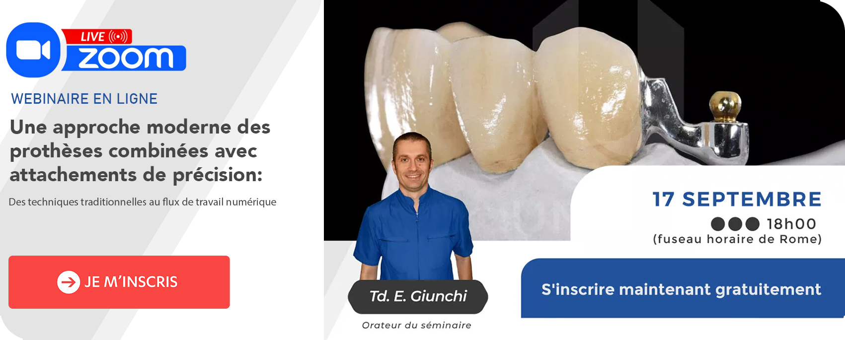 Fixed and removable dentures | Sodimed