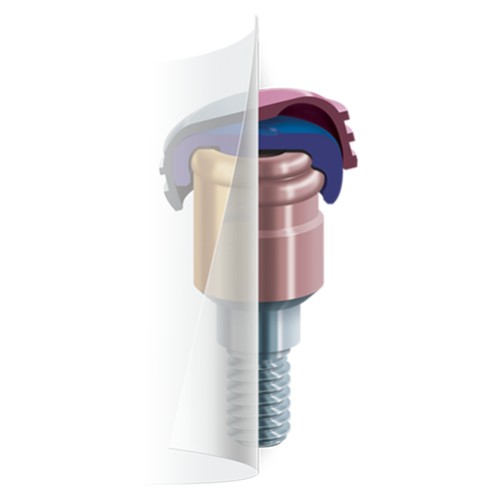 LOCATOR RTX presentation | Sodimed implant attachments accessories